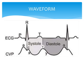 Central venous pressure | PPTX