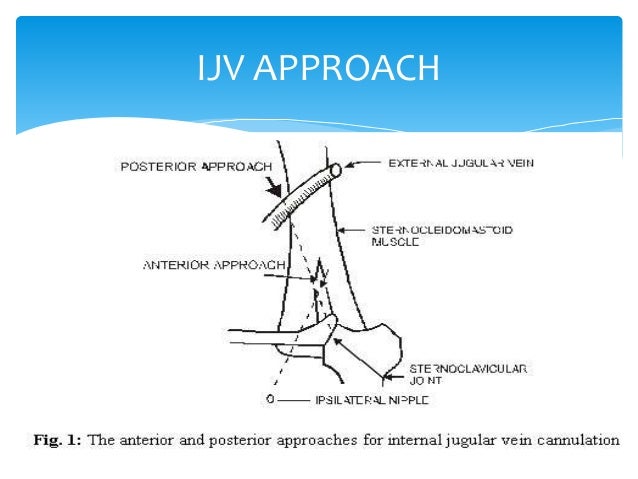 Central venous pressure