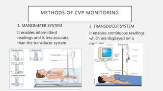 CENTRAL VENOUS PRESSURE MONITORING.pptx