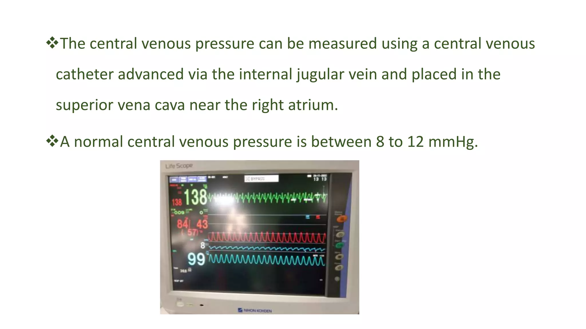 CENTRAL VENOUS PRESSURE.pptx