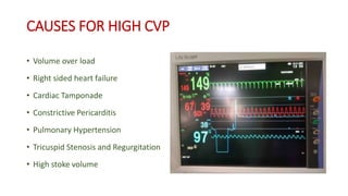 CENTRAL VENOUS PRESSURE.pptx