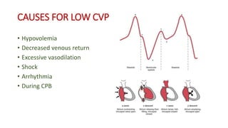 CENTRAL VENOUS PRESSURE.pptx