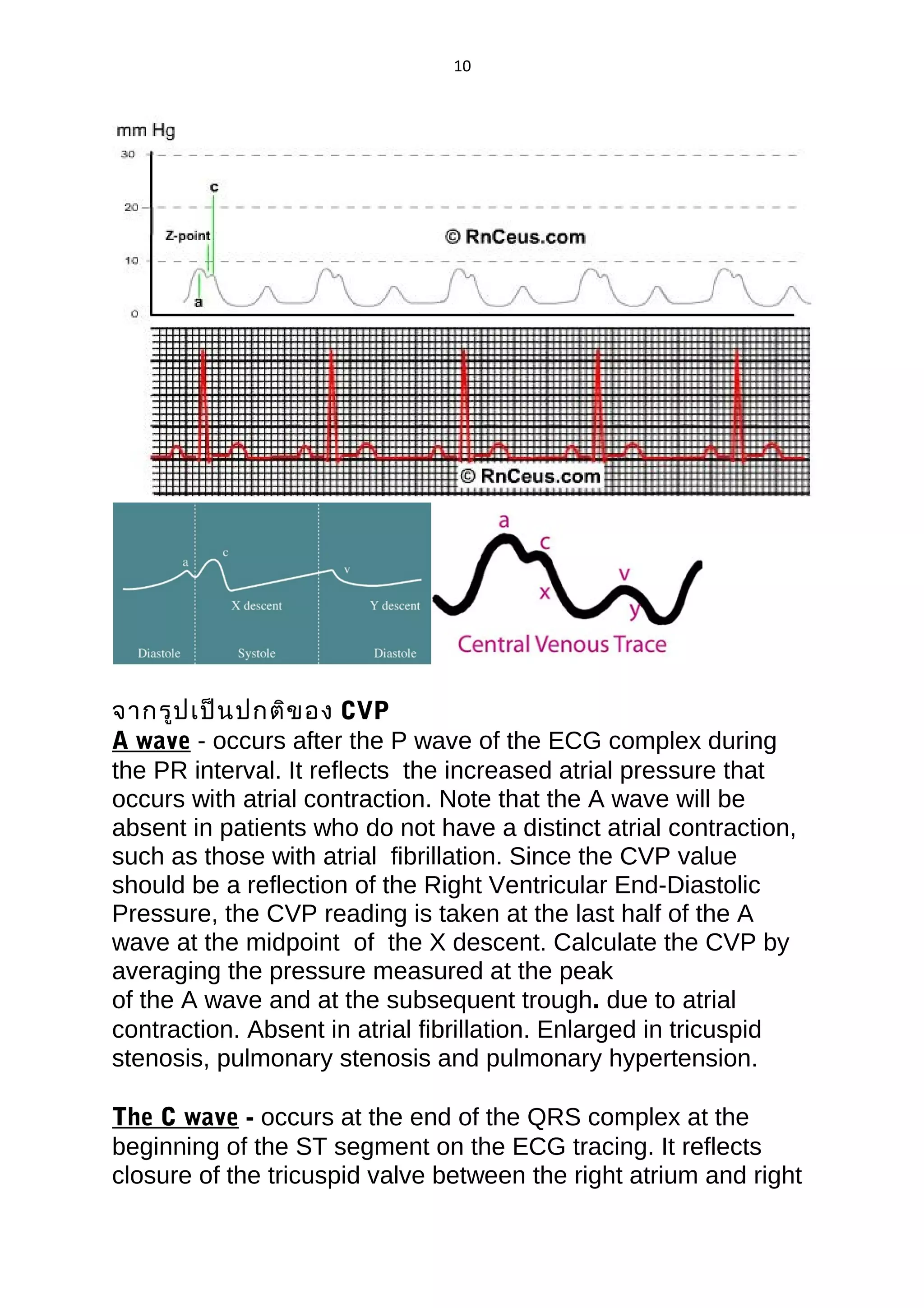 Central venous pressure (cvp) | DOC