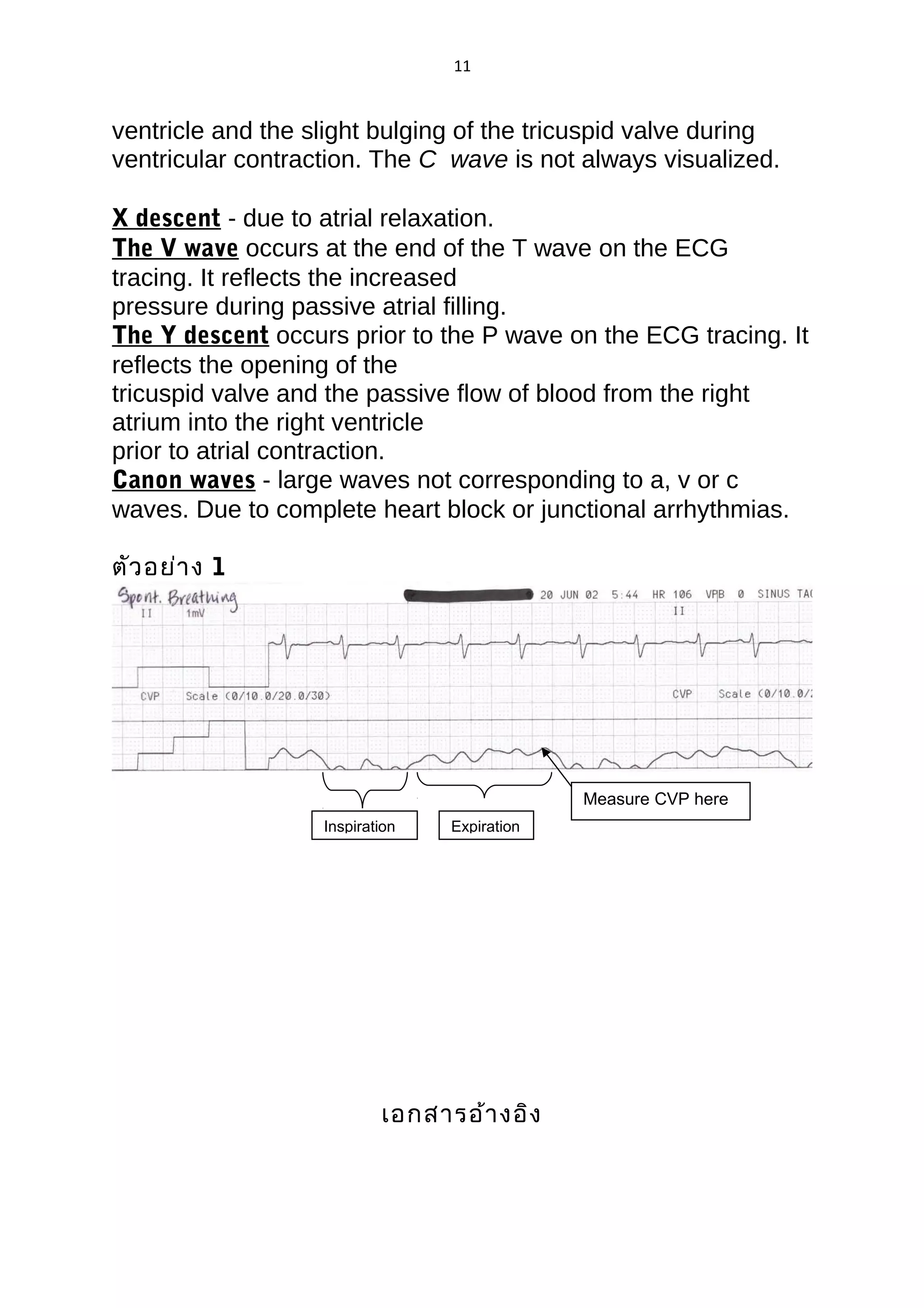 Central venous pressure (cvp) | DOC