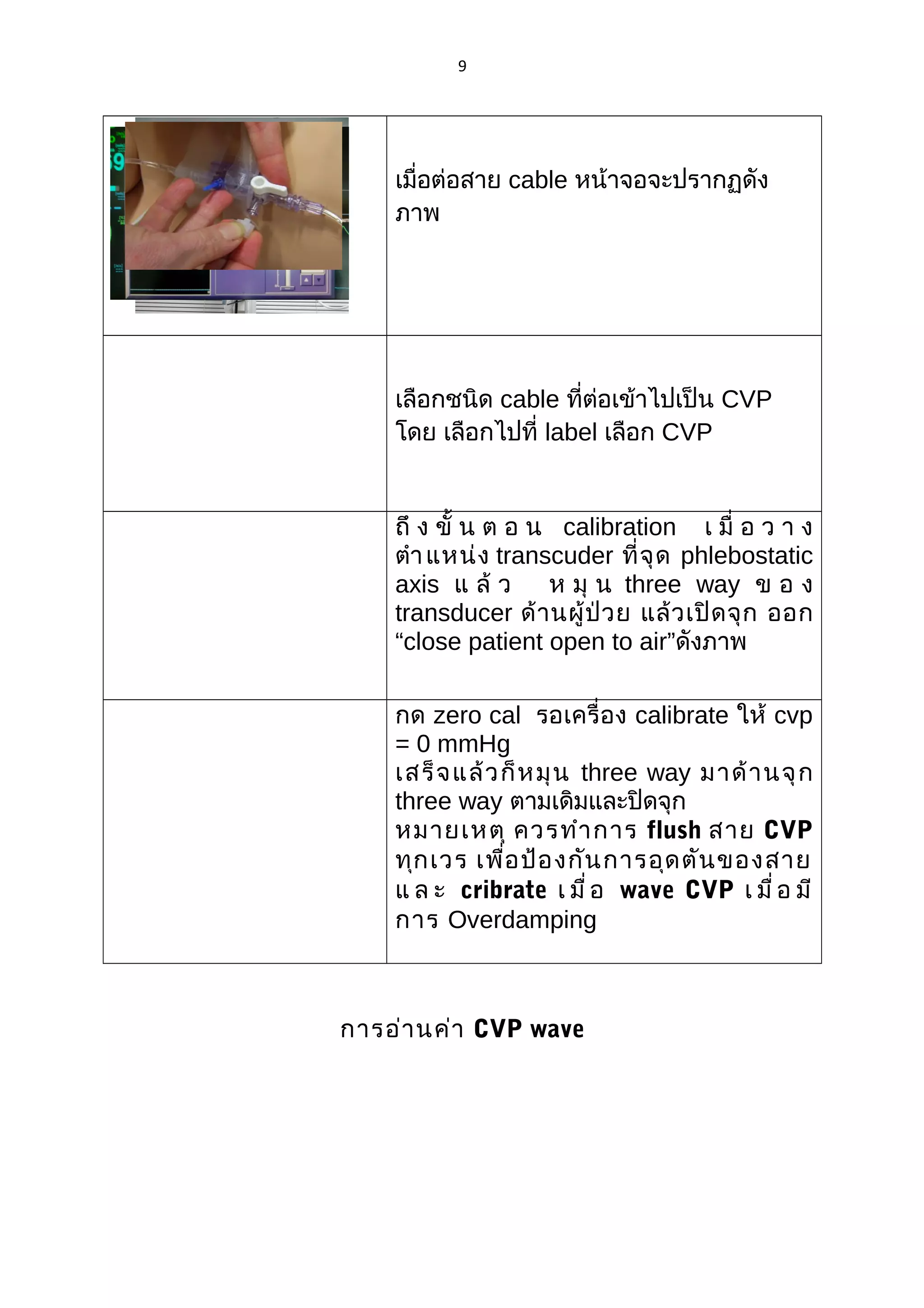 Central venous pressure (cvp) | DOC