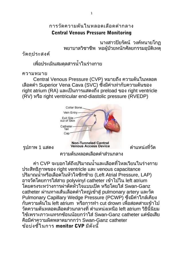 Central venous pressure (cvp) | DOC