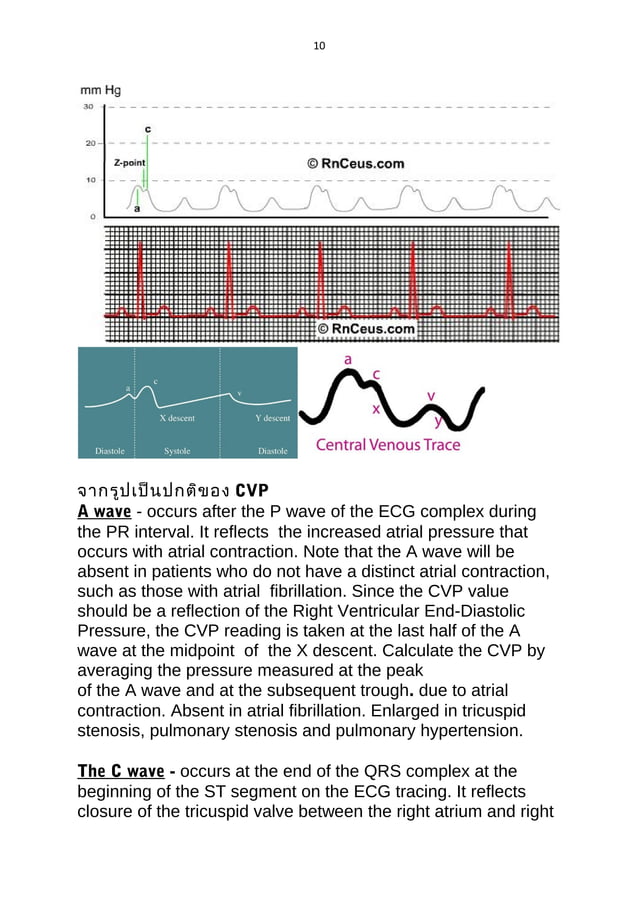 Central venous pressure (cvp) | DOC