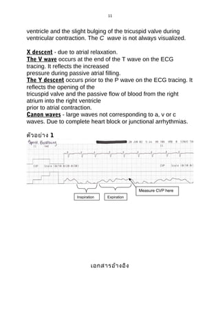 Central venous pressure (cvp) | DOC