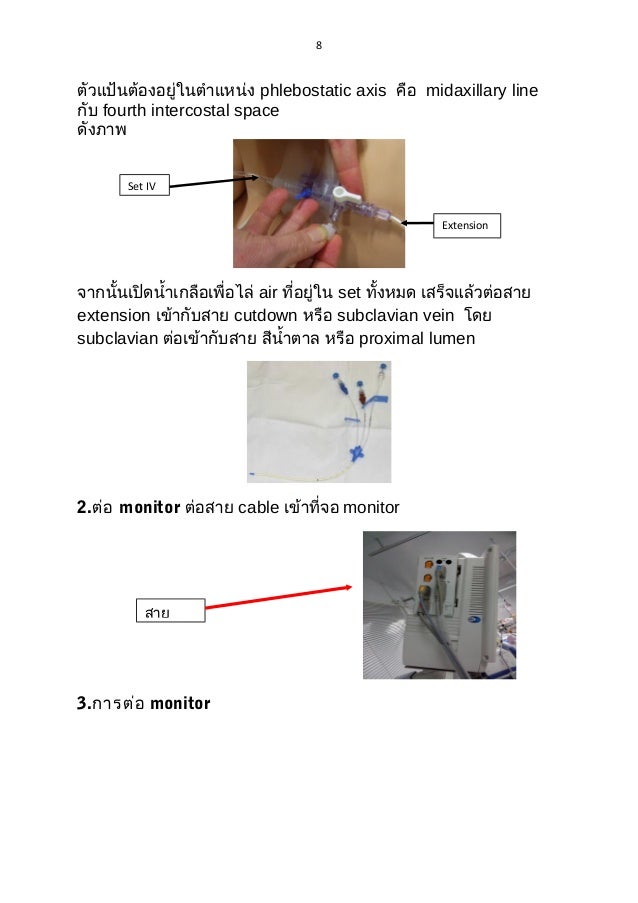 Central venous pressure (cvp)