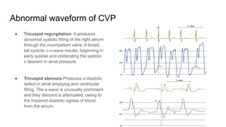CENTRAL VENOUS PRESSURE MONITORINGG.pptx