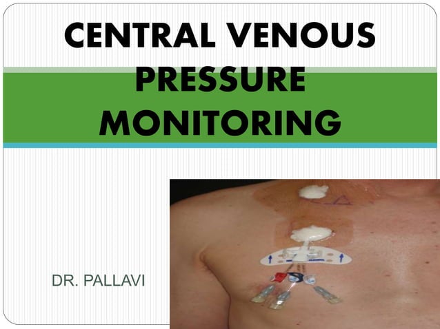 Central venous pressure monitoring | PPTX