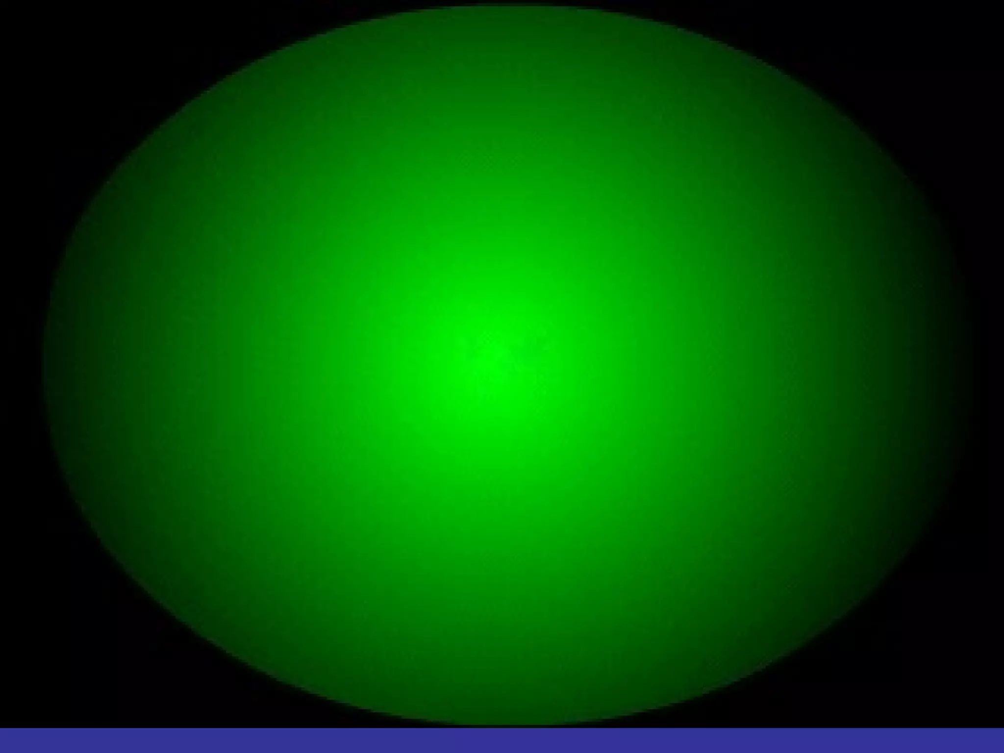 Central vertigo recent perspectives | PPT | Brain and Nervous System ...