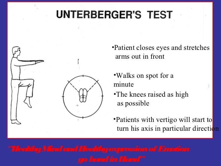 Central vertigo recent perspectives