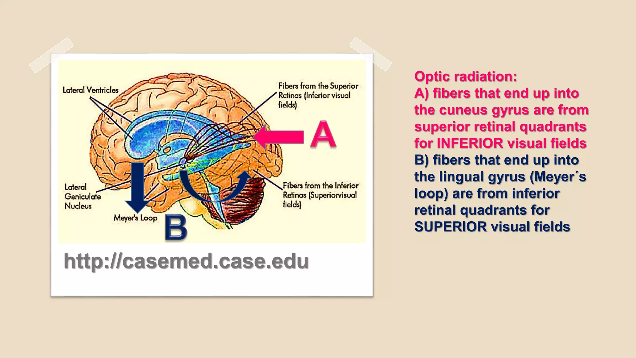 Central visual pathways | PPSX | Eye and Vision Conditions | Diseases ...