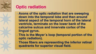 Central visual pathways | PPSX | Eye and Vision Conditions | Diseases ...