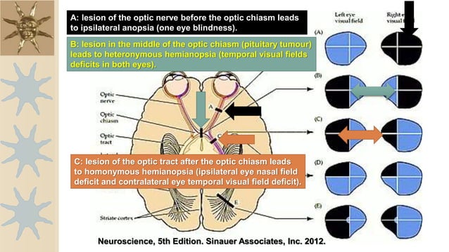 Central visual pathways | PPT