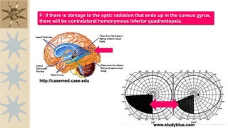Central visual pathways | PPSX | Eye and Vision Conditions | Diseases ...