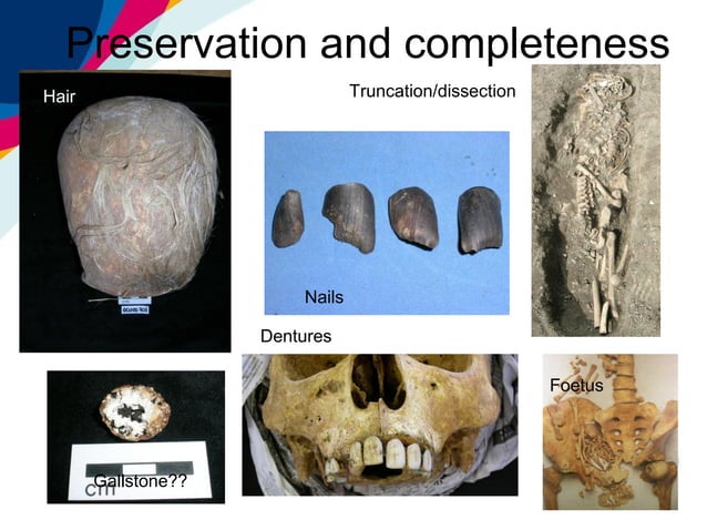 Centre for Human Bioarchaeology | PPT