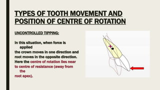 Centre of rotation | PPTX