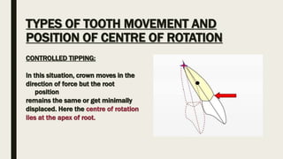 Centre of rotation | PPTX