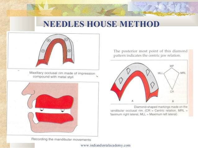 Centric and eccentric jaw relation / dental courses