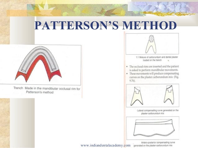 Centric and eccentric jaw relation / dental courses