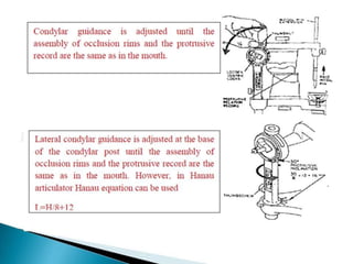 Centric and eccentric record in complete denture 3rd yr | PPTX