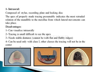 Centric and eccentric record in complete denture 3rd yr | PPTX