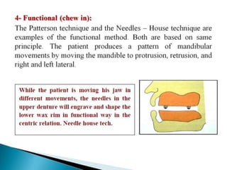 Centric and eccentric record in complete denture 3rd yr | PPTX