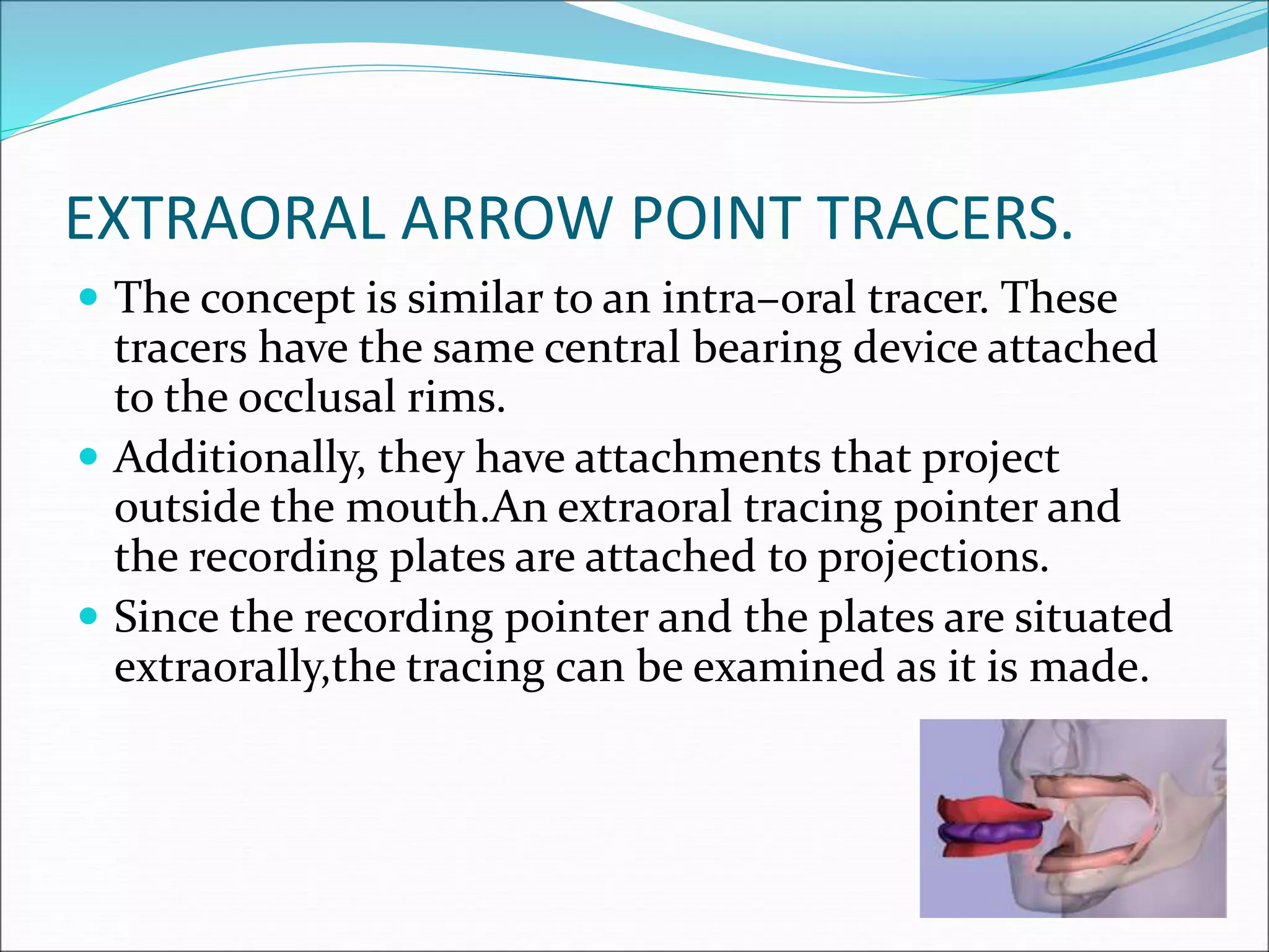 Centric jaw relation by Dr Rajanikanth AV | PPT