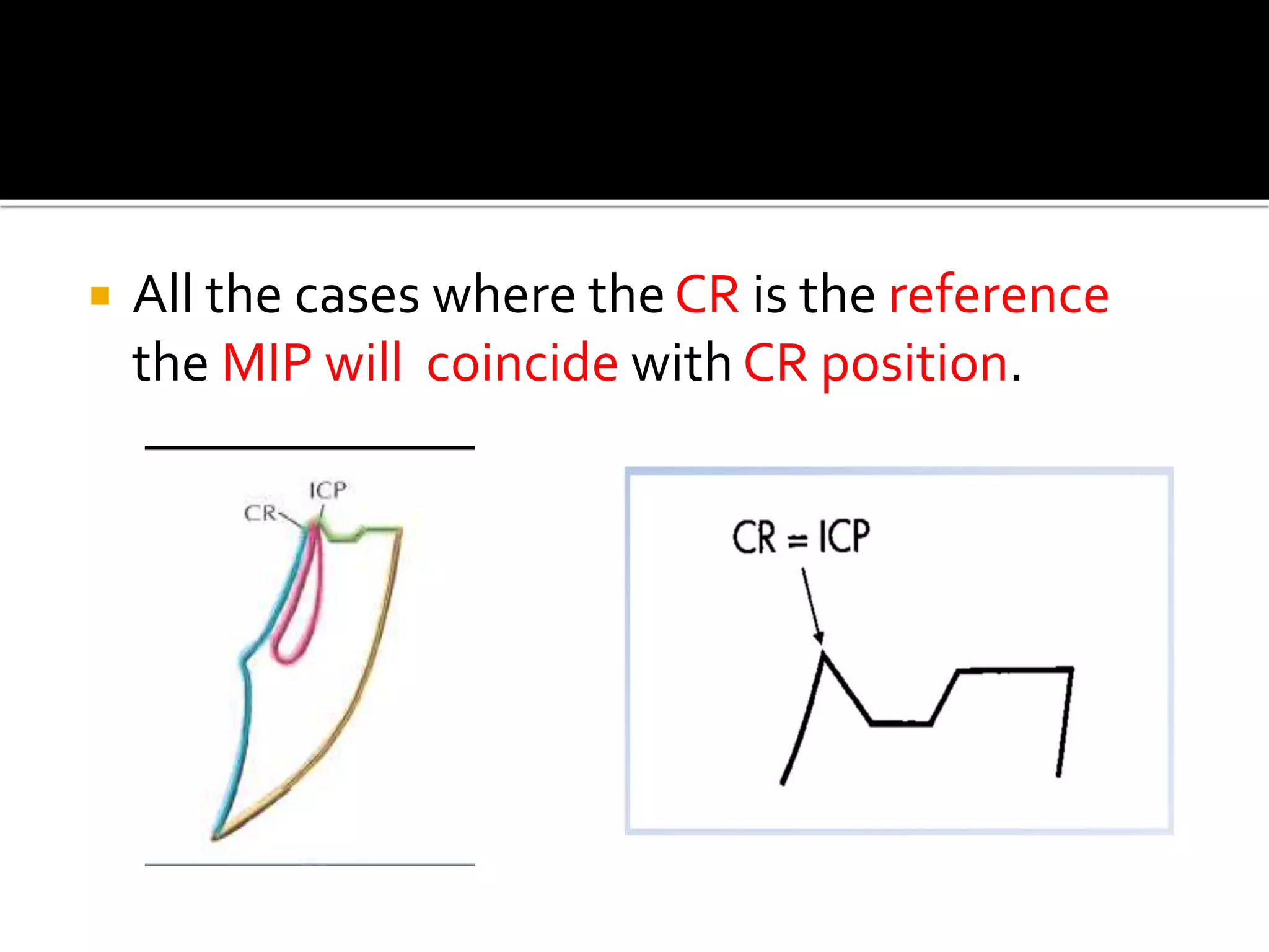 Centric relation | PPTX