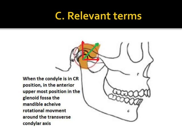 Centric relation | PPTX | Dental Health | Diseases and Conditions