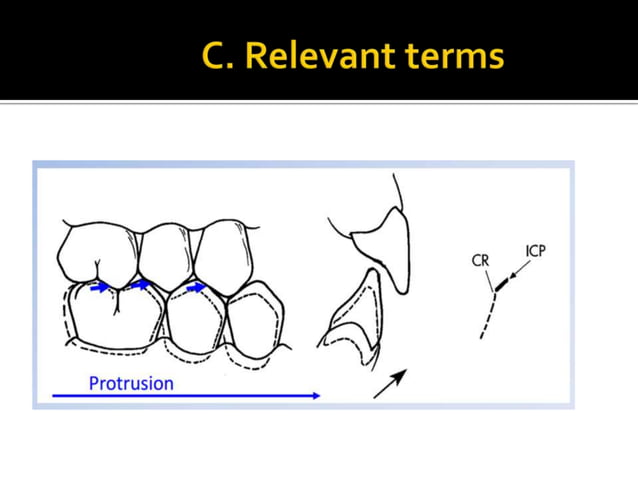 Centric relation | PPTX | Dental Health | Diseases and Conditions
