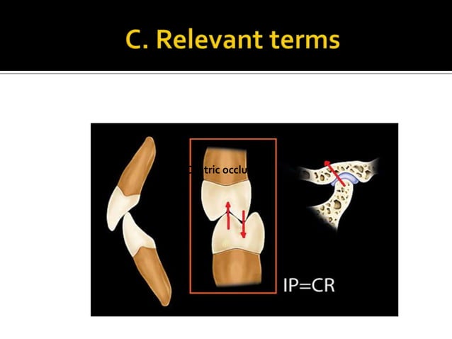 Centric relation | PPTX | Dental Health | Diseases and Conditions