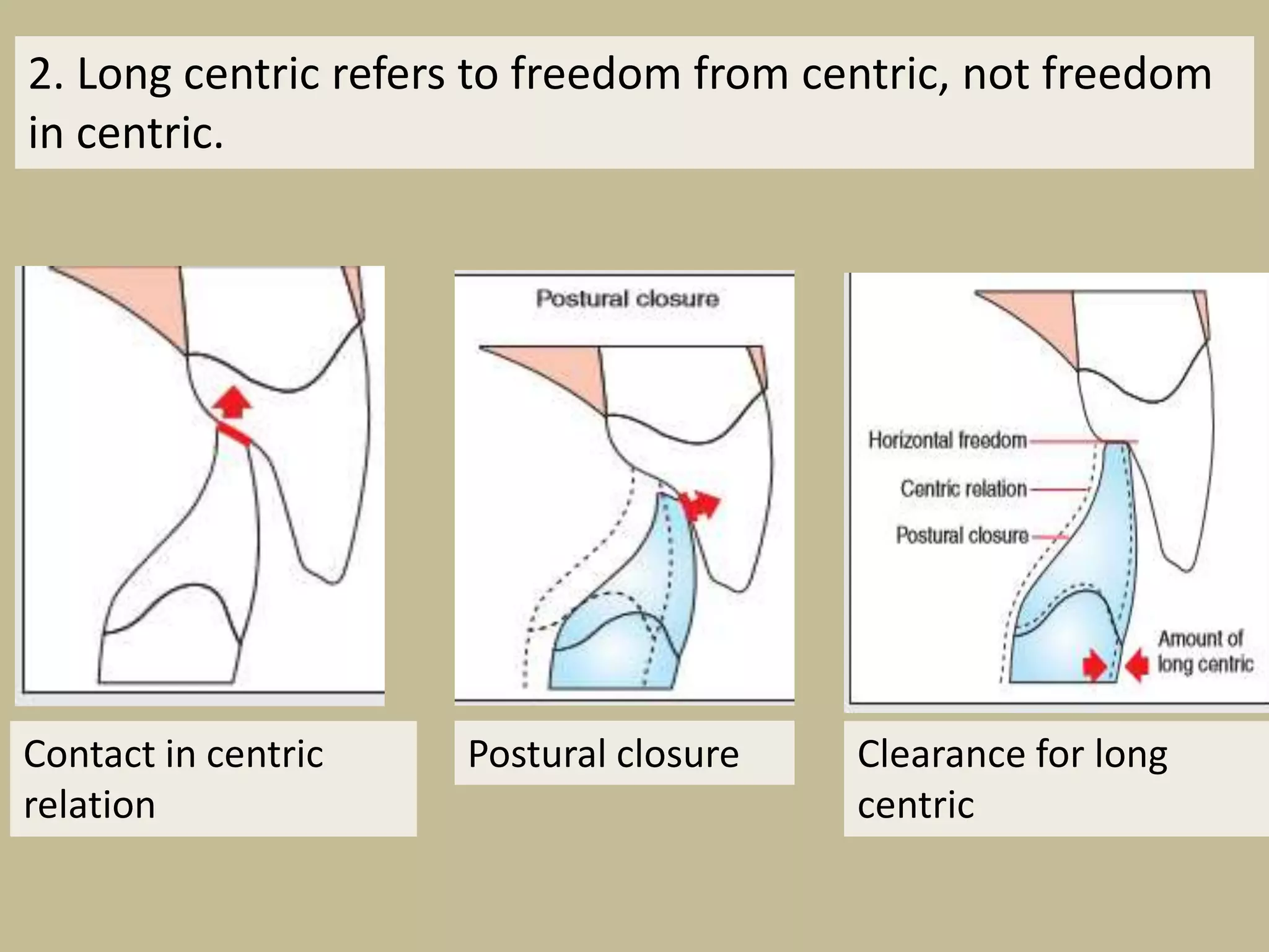 CENTRIC RELATION.pptx