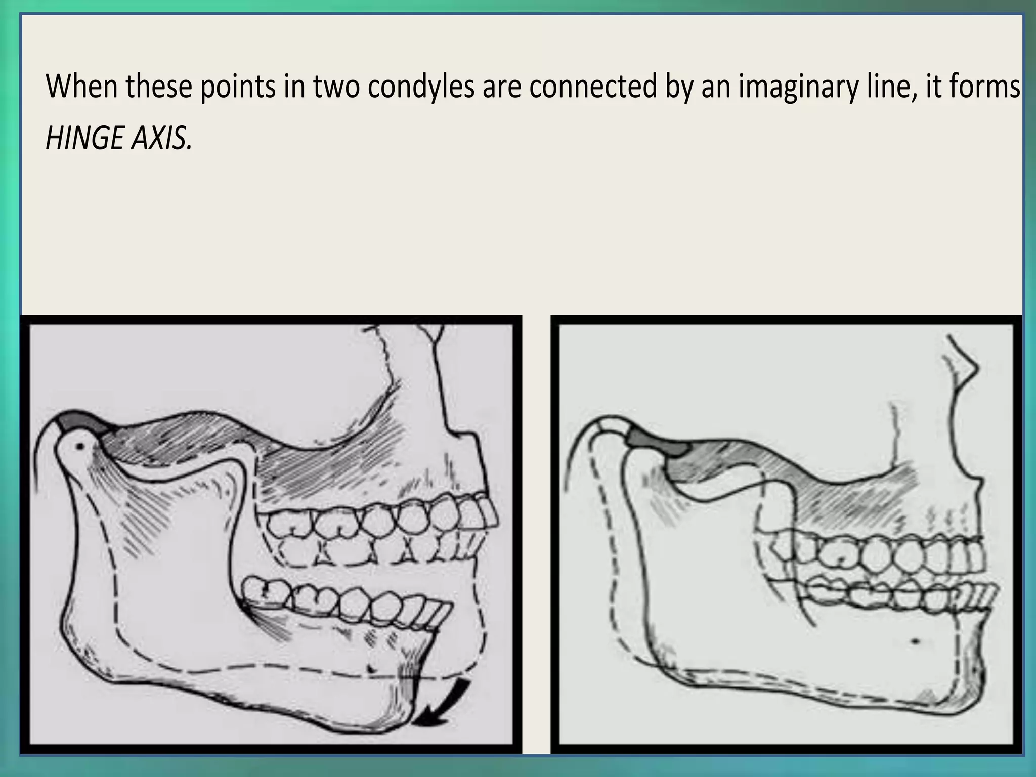 CENTRIC RELATION.pptx
