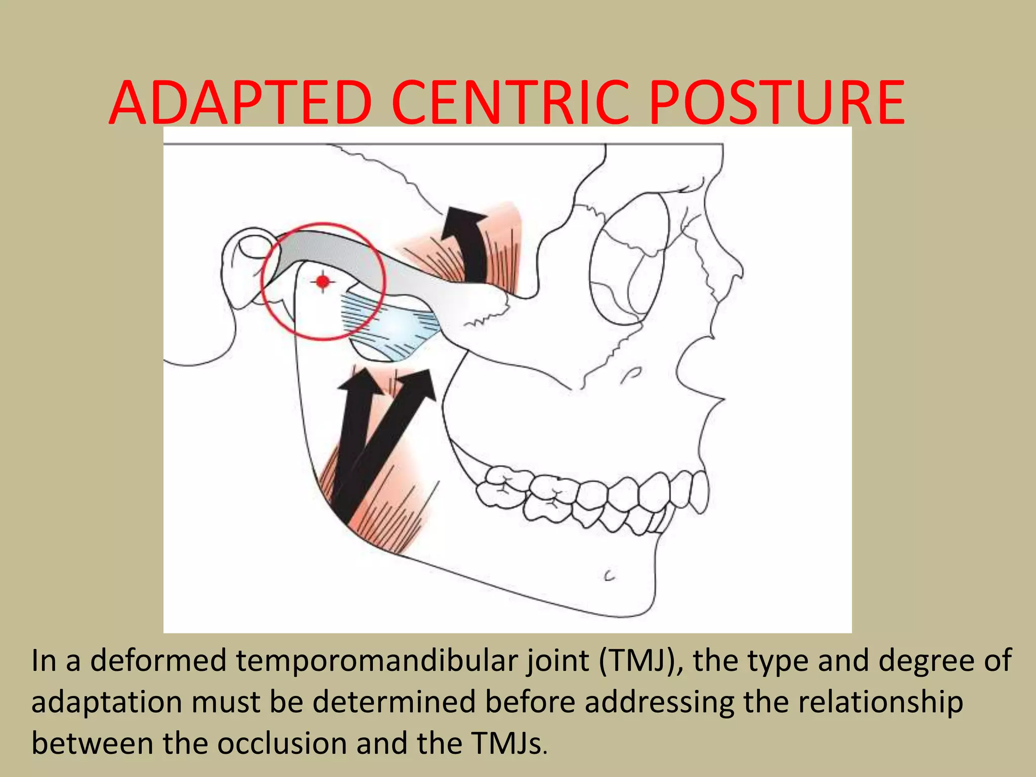 CENTRIC RELATION.pptx