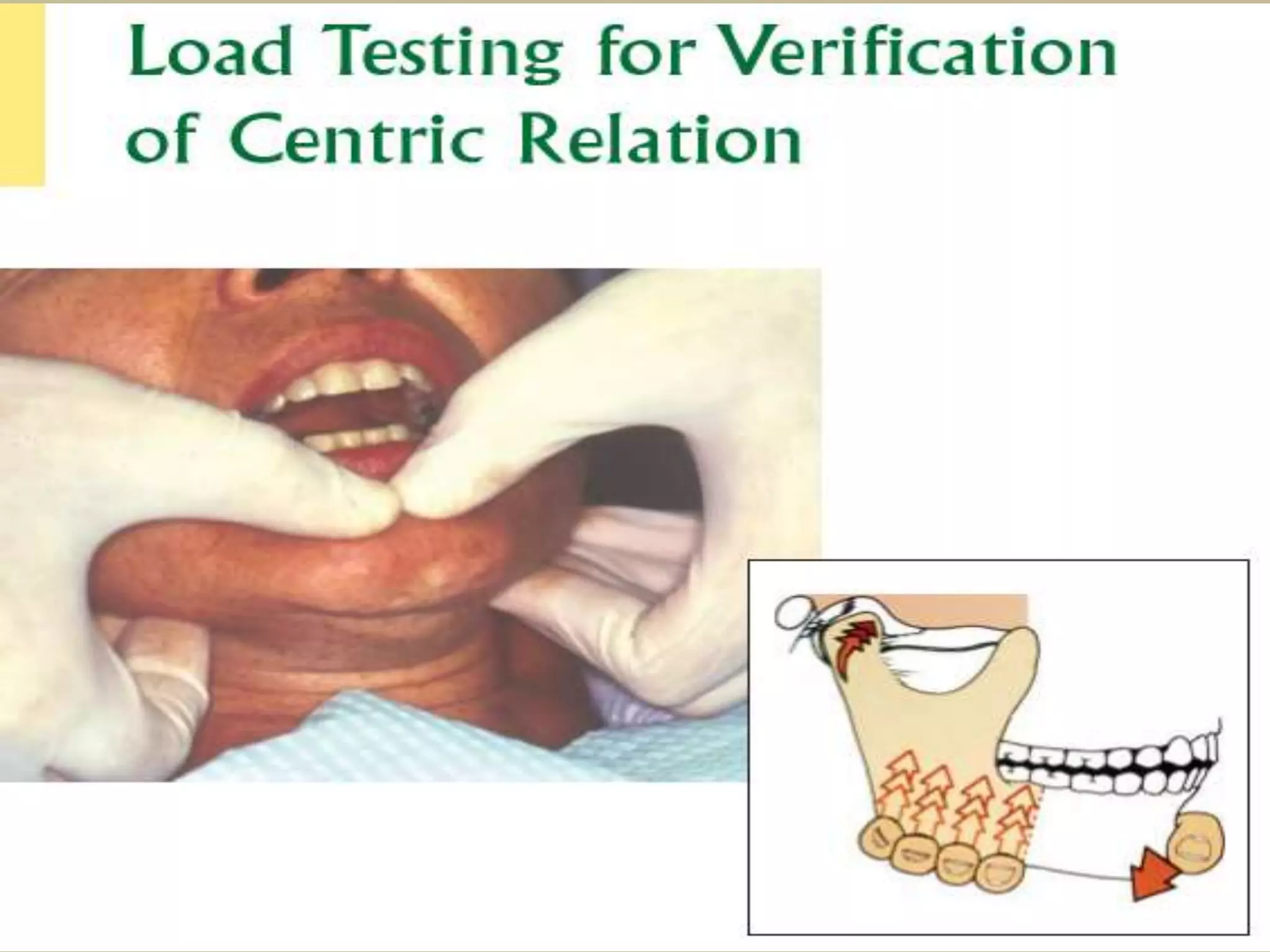 CENTRIC RELATION.pptx