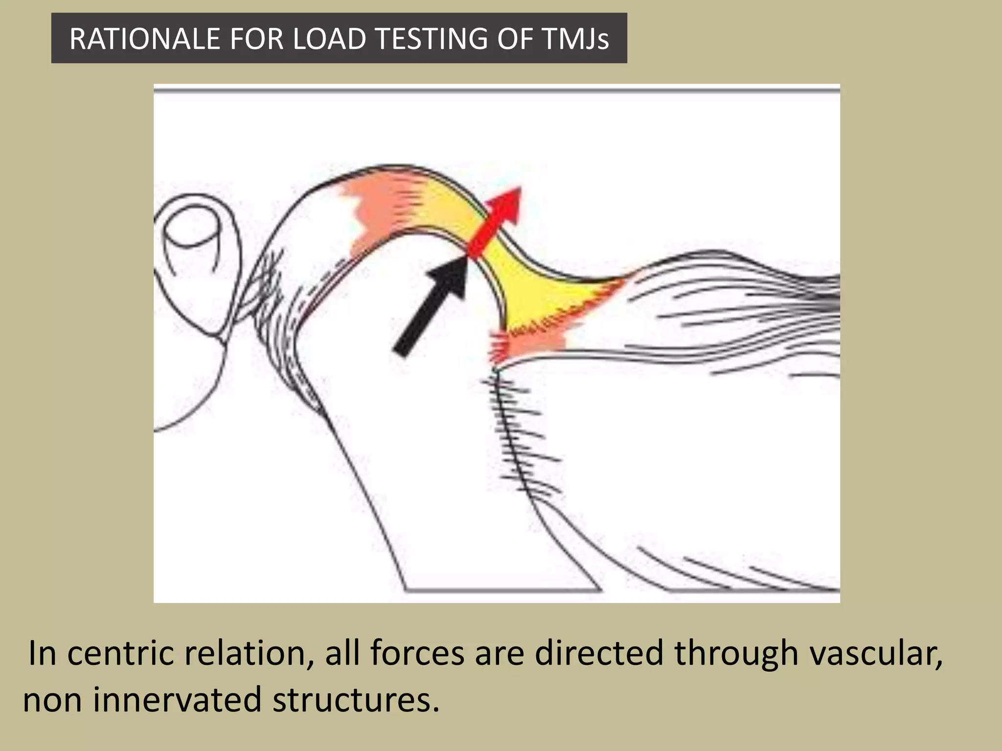 CENTRIC RELATION.pptx
