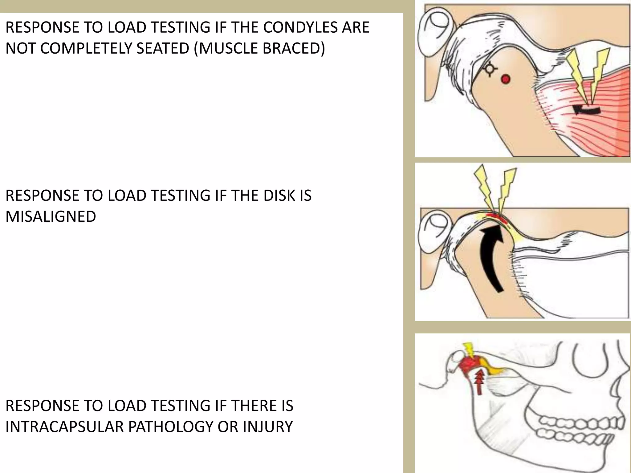 CENTRIC RELATION.pptx