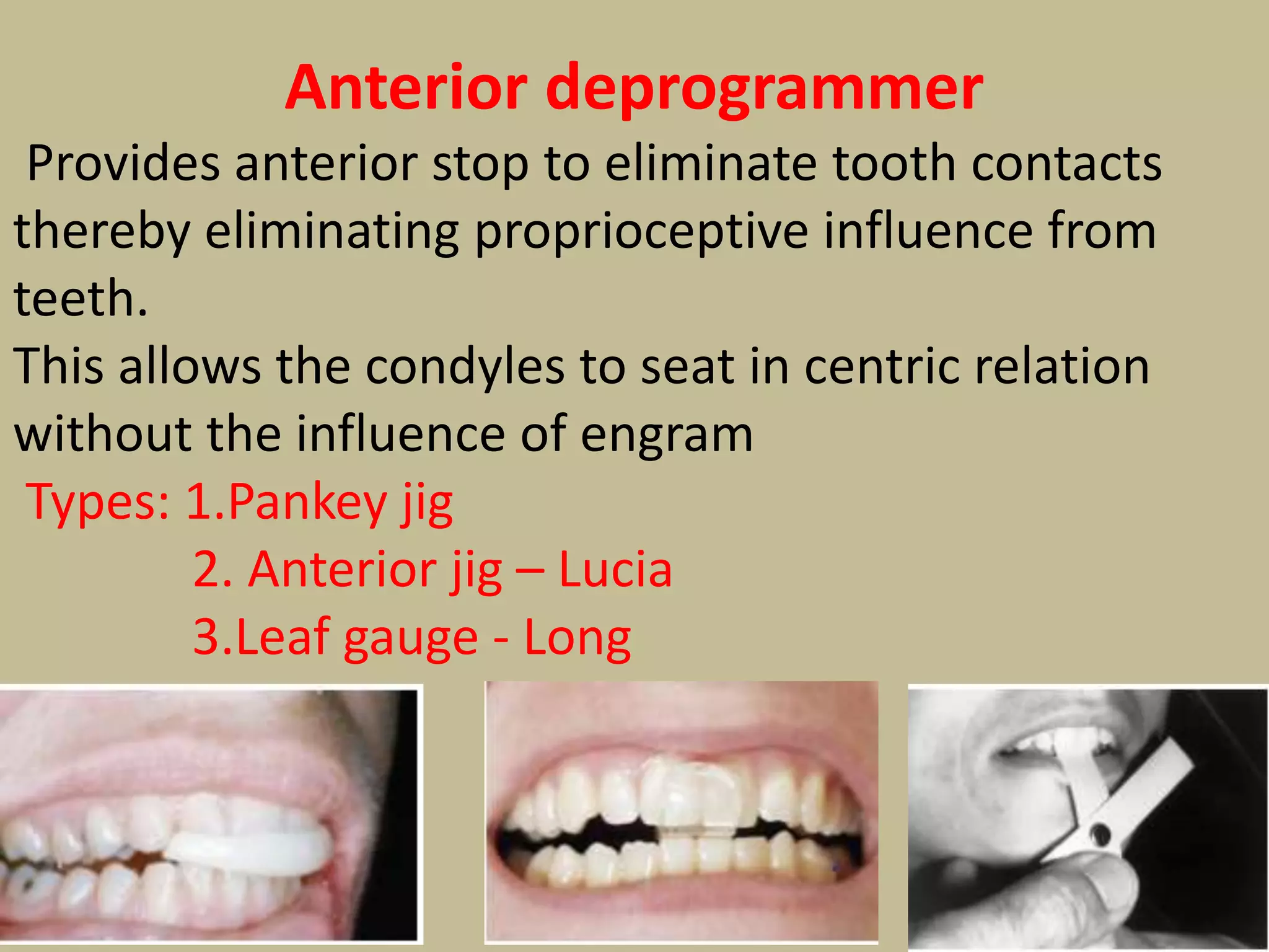 Centric Relation Pptx