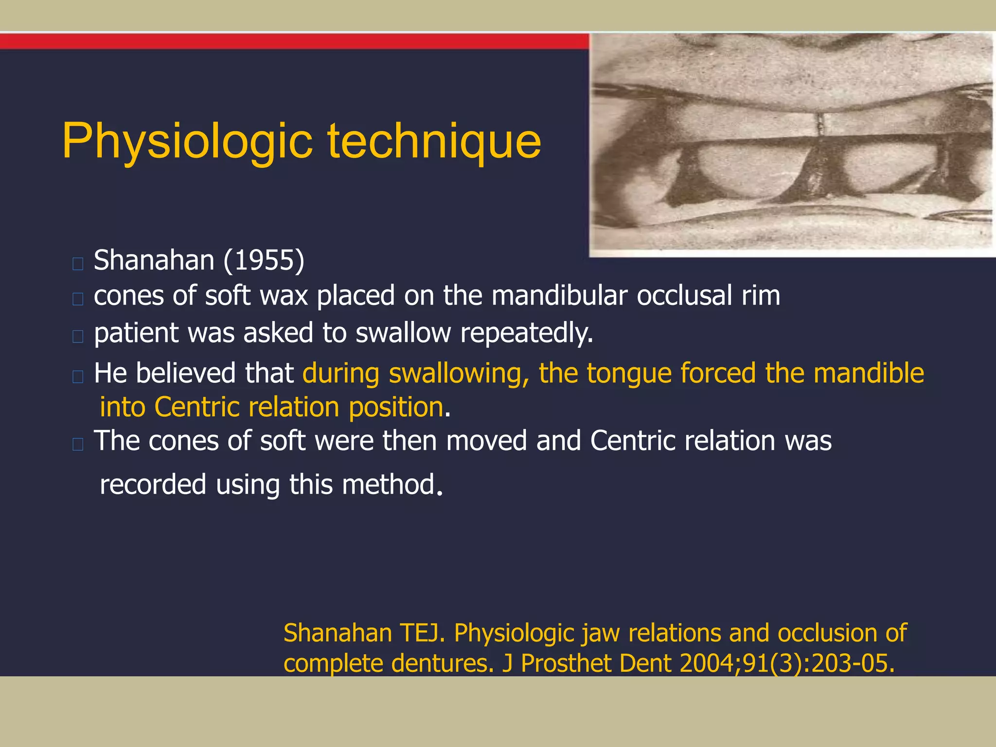 CENTRIC RELATION.pptx