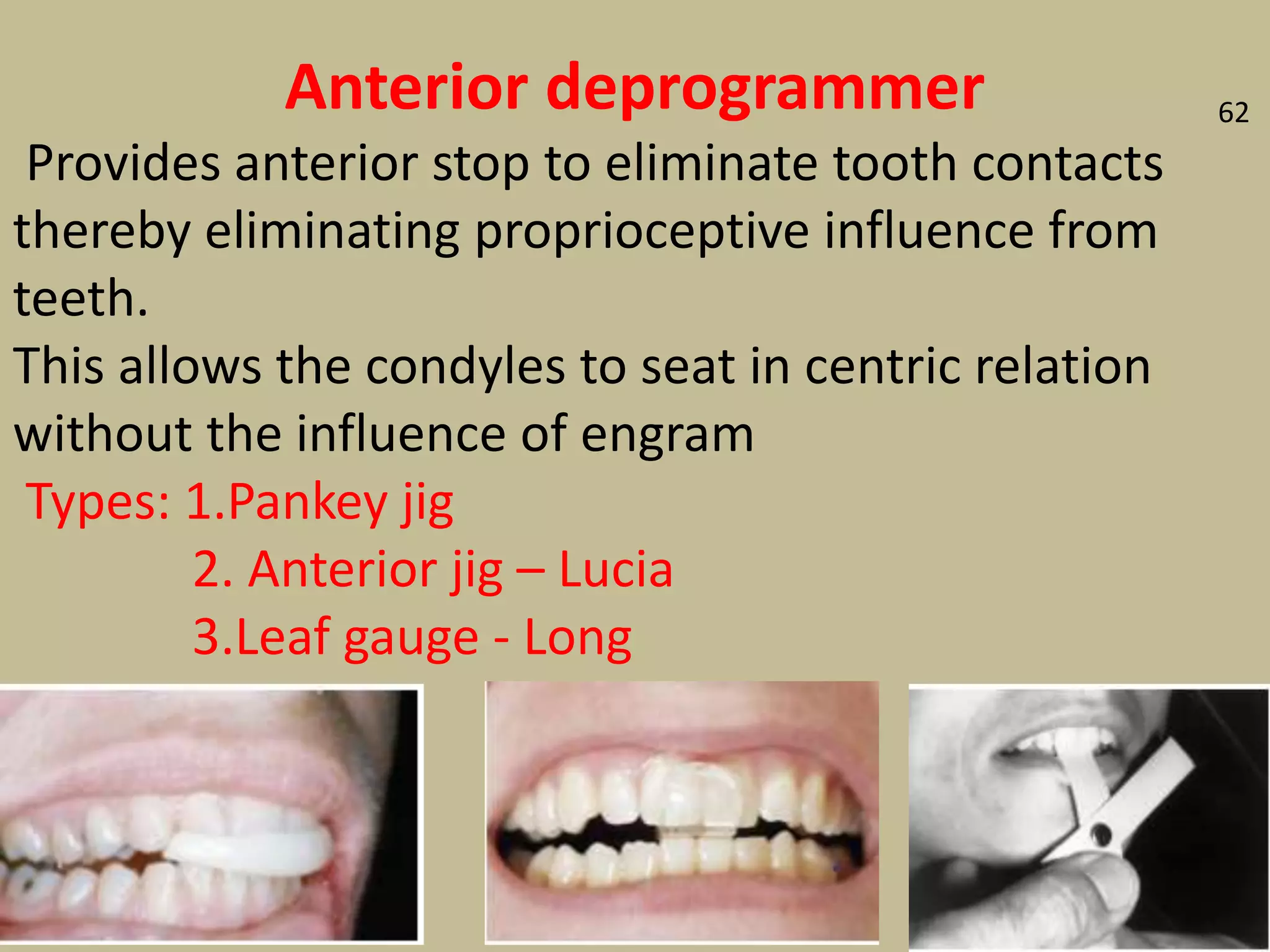 CENTRIC RELATION.pptx