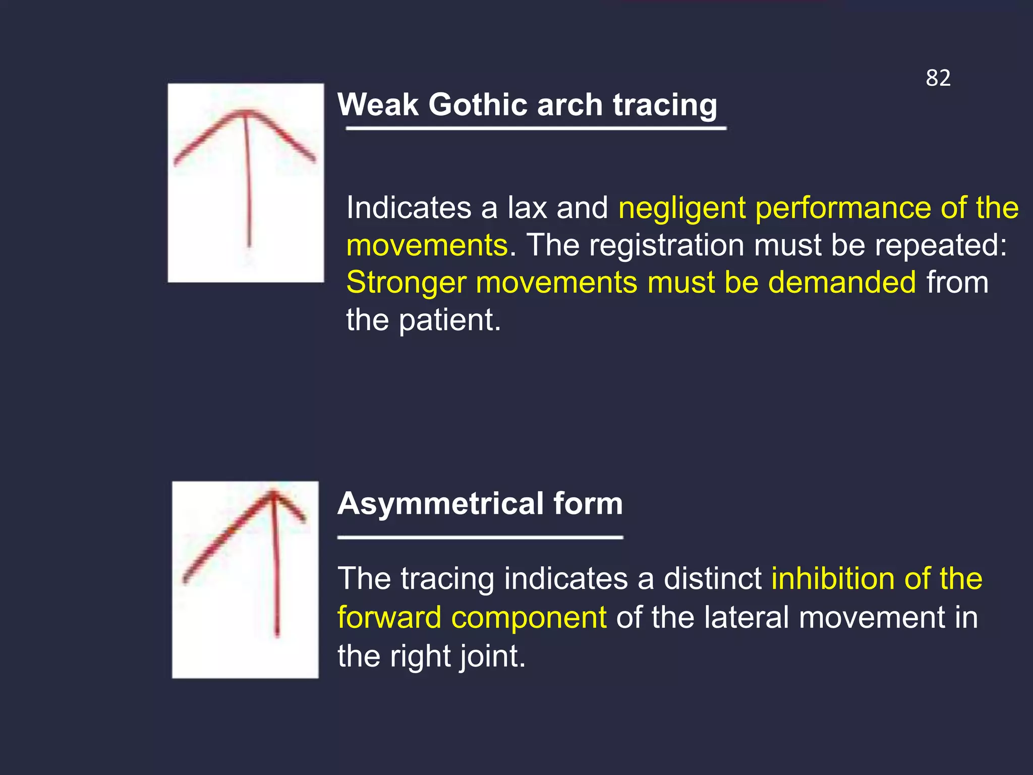 CENTRIC RELATION.pptx