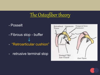 CENTRIC RELATION.pptx