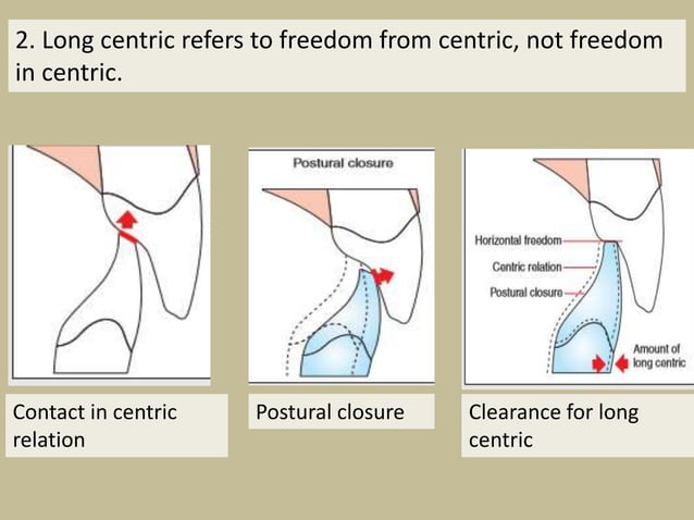 CENTRIC RELATION.pptx