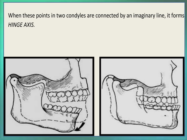 CENTRIC RELATION.pptx