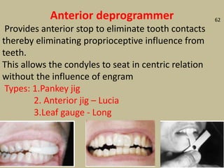 CENTRIC RELATION.pptx