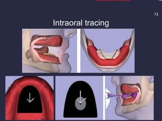 CENTRIC RELATION.pptx