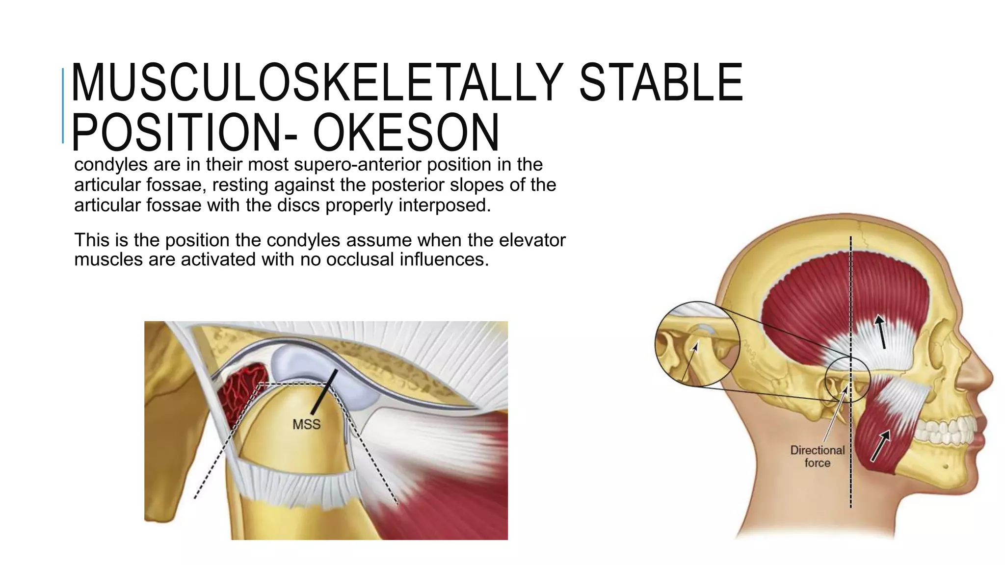 Centric Relation .pptx